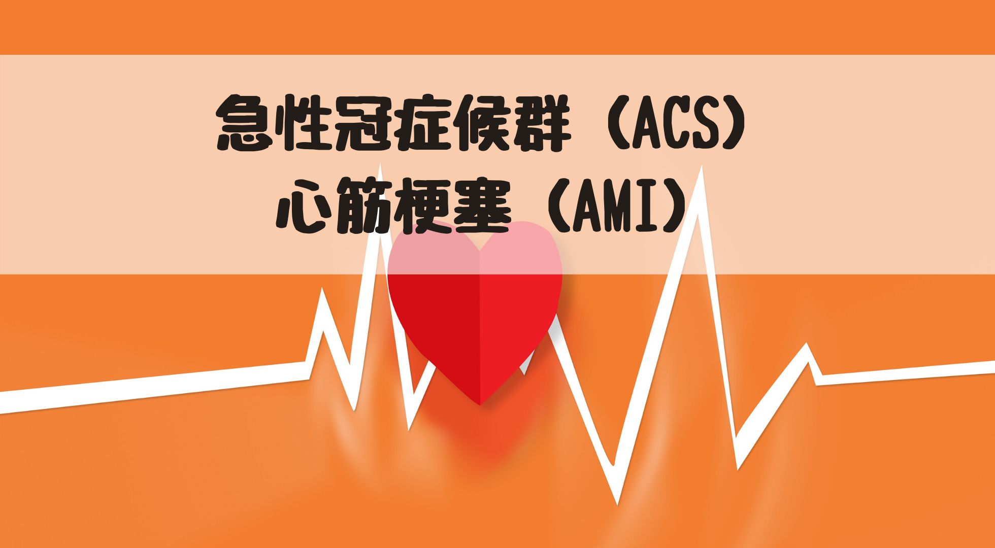 【疾患】急性冠症候群（ACS）・心筋梗塞（AMI）【随時更新中】｜踊る救急医