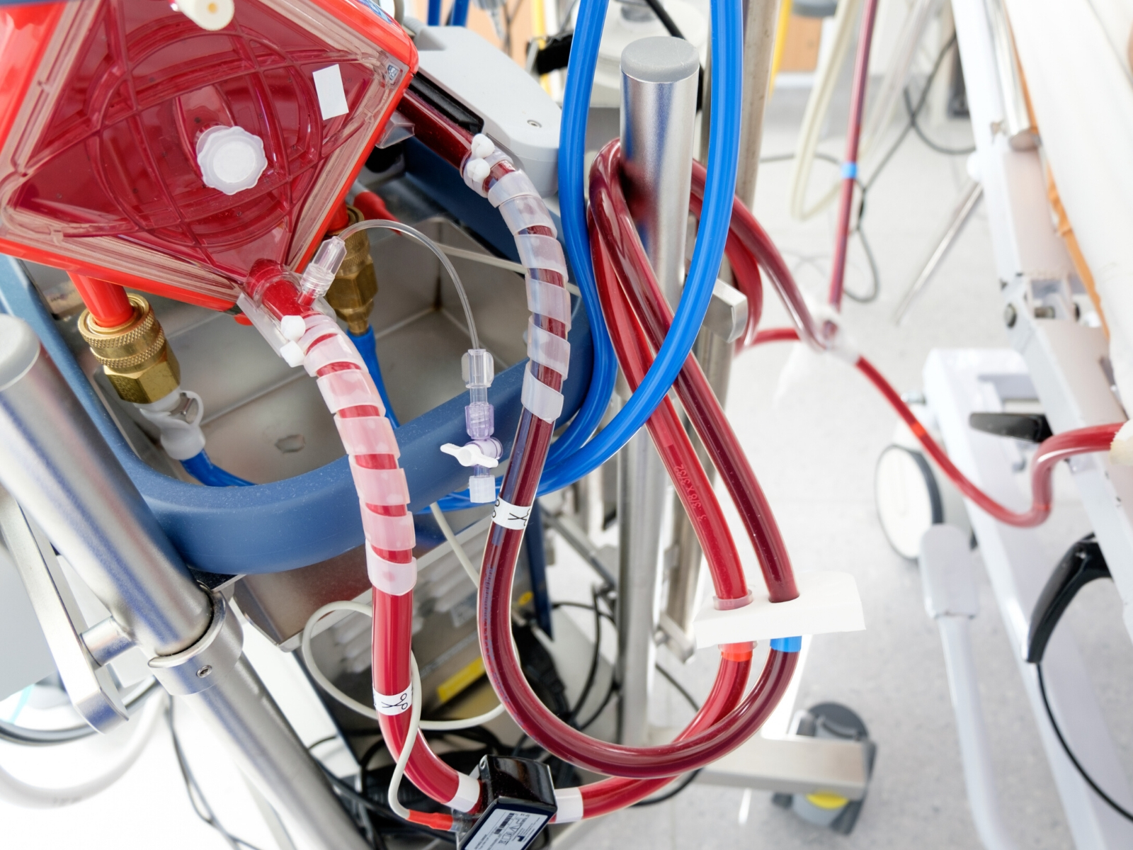 ECMO回路の仕組みと構成要素について｜踊る救急医