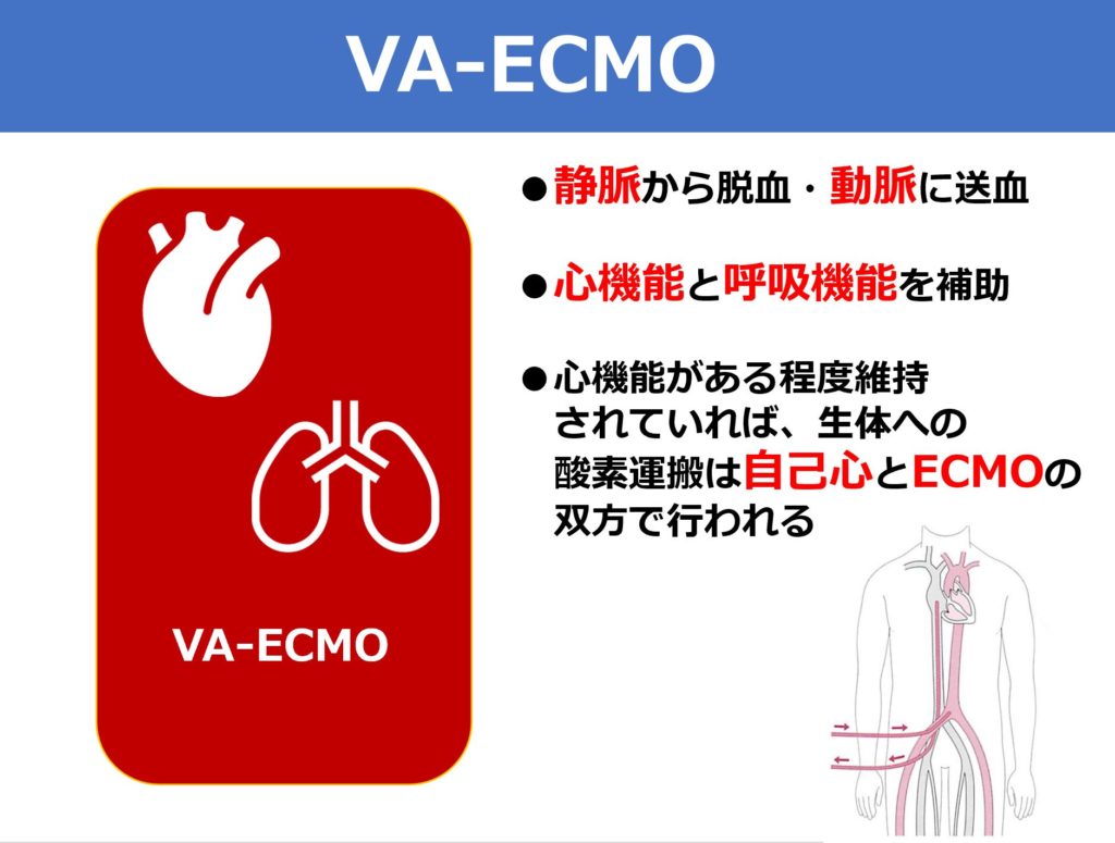 ECMOとは？【ECMO・PCPSについて簡単に解説】｜踊る救急医