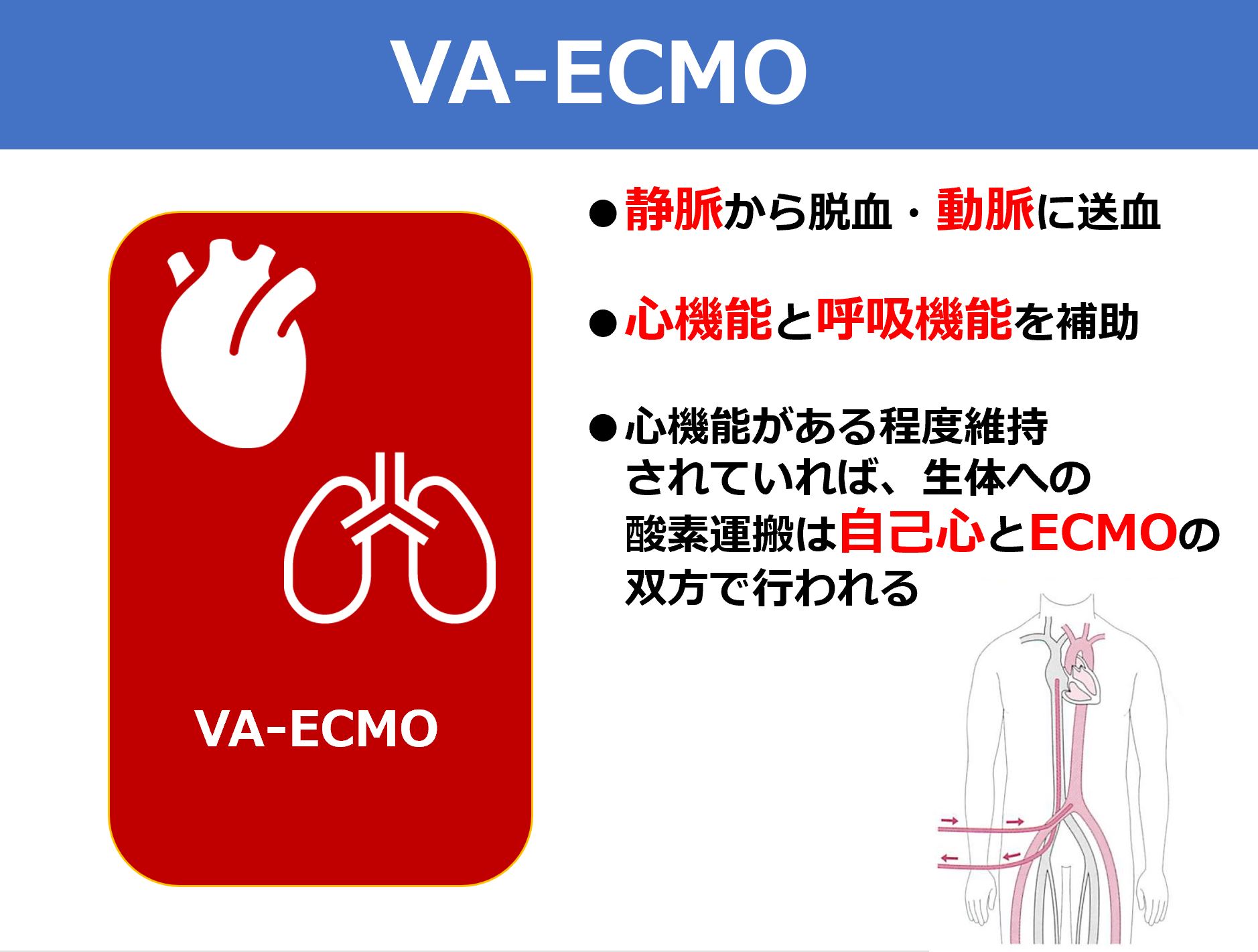 ECMOとは？【ECMO・PCPSについて簡単に解説】｜踊る救急医