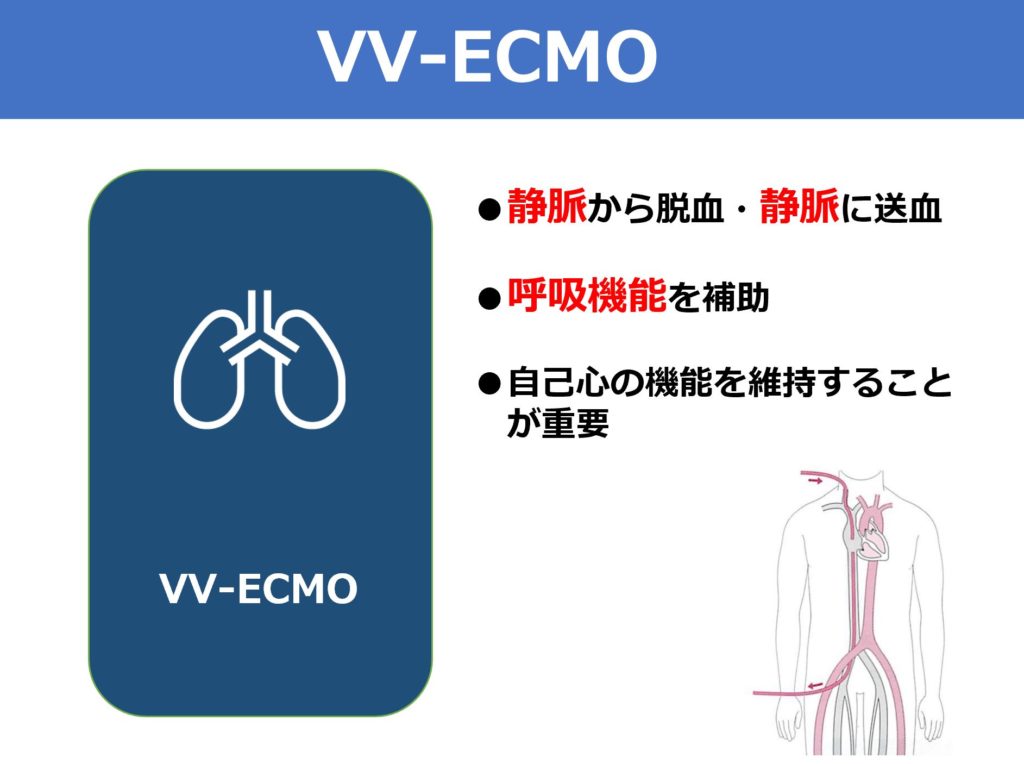 ECMOとは？【ECMO・PCPSについて簡単に解説】｜踊る救急医