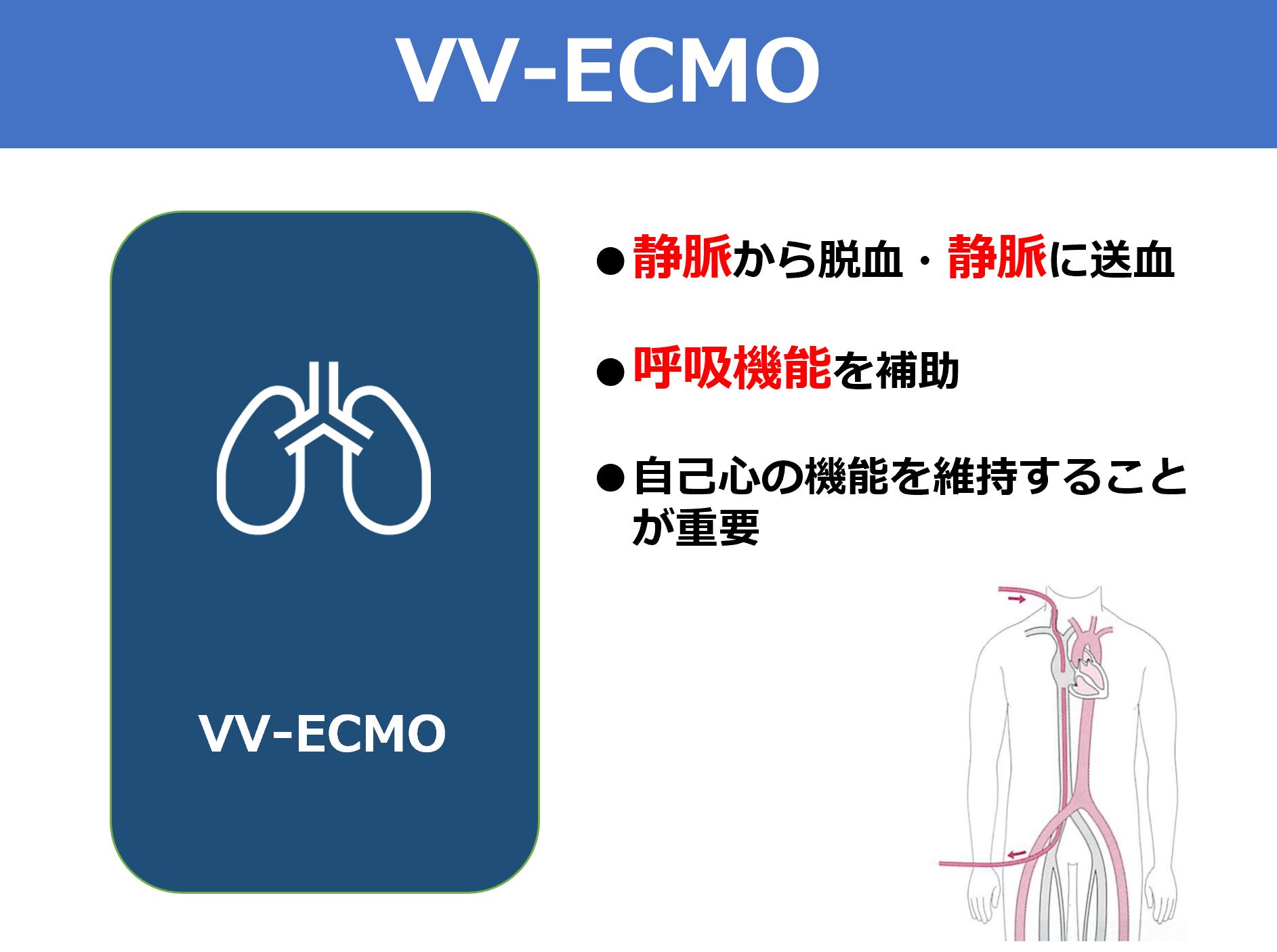 ECMOとは？【ECMO・PCPSについて簡単に解説】｜踊る救急医