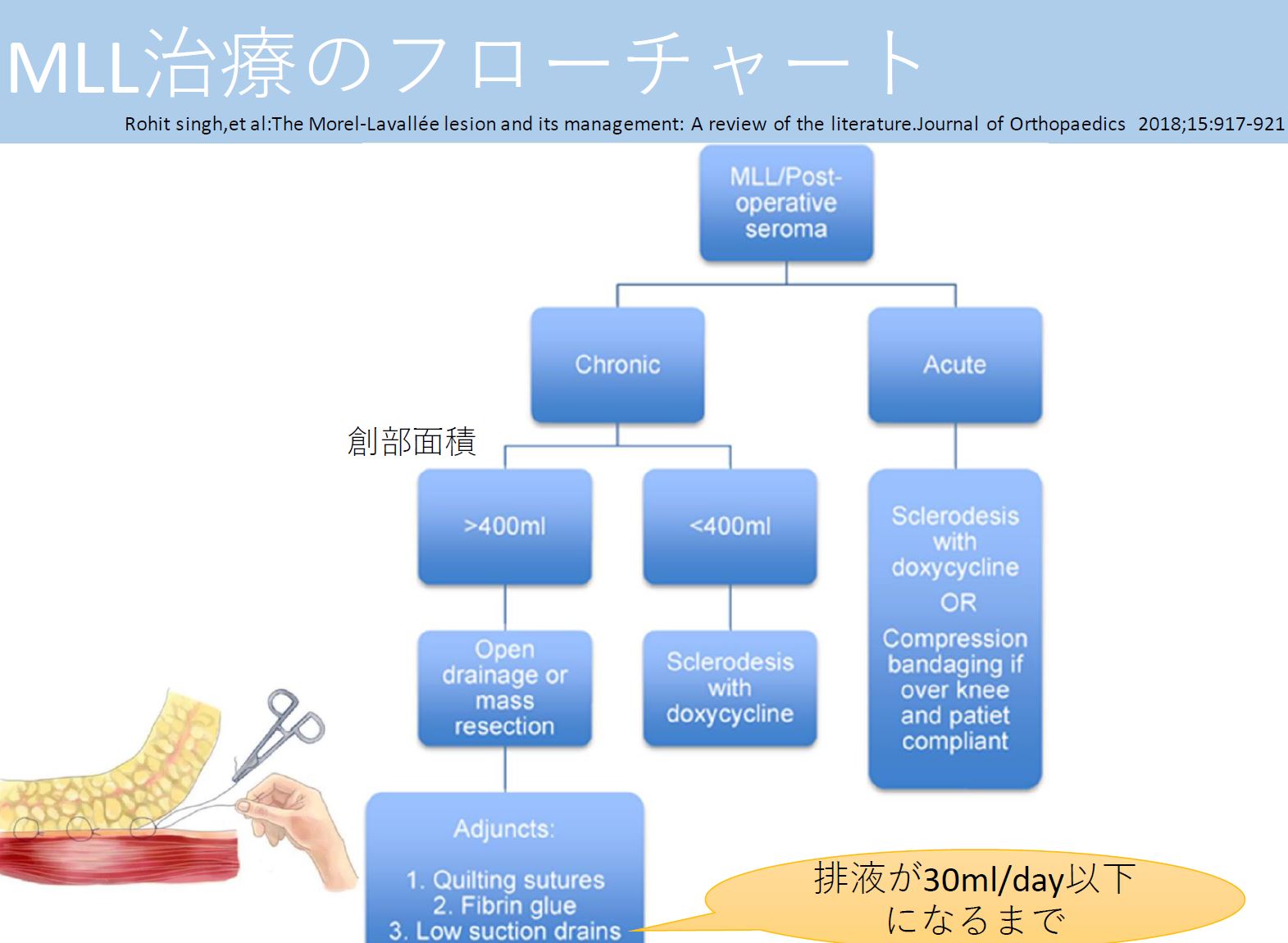 Morel Lavallée lesion (MLL)とは？【重症外傷で見られる血腫では注意すべき疾患です】｜踊る救急医